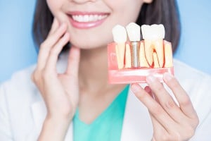 General & Cosmetic Dentistry Dorchester | Dr. Robert Perry Dental